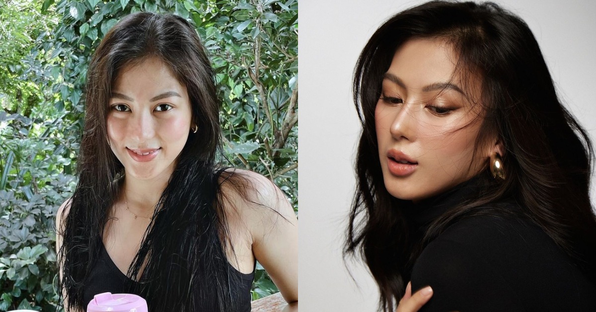 Alex Gonzaga gets a nose job: 'I say do what makes you happy' • PhilSTAR Life